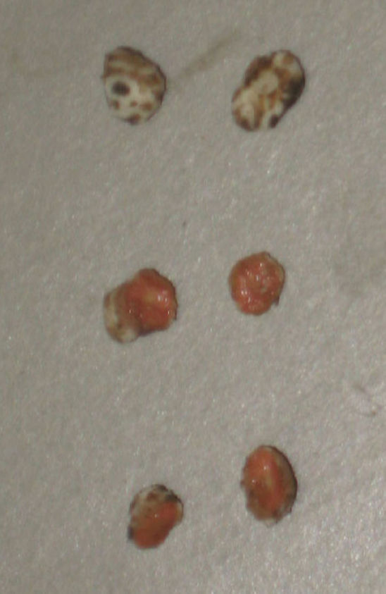 Soybean Nodulation | Pioneer Seeds